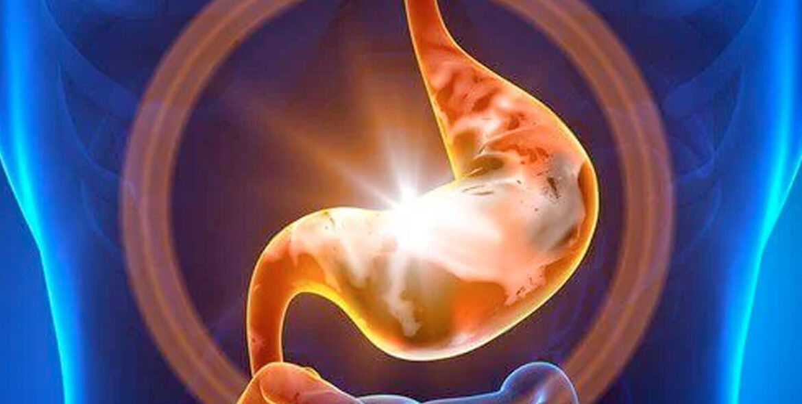 Gastroenterite aguda (GEA) – Dr. Tulio Assis